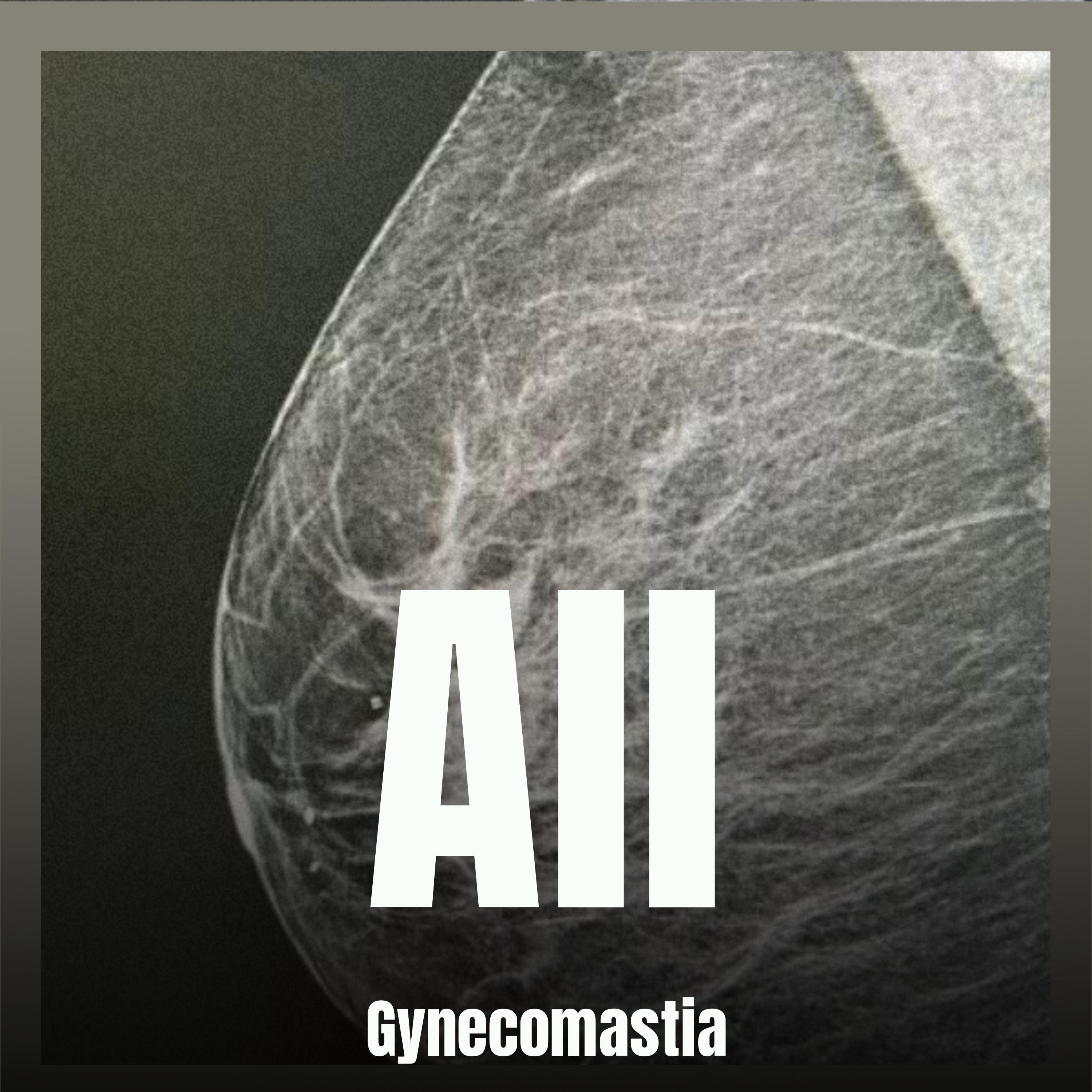 All Gynecomastia - Various Artists - 专辑 - 网易云音乐