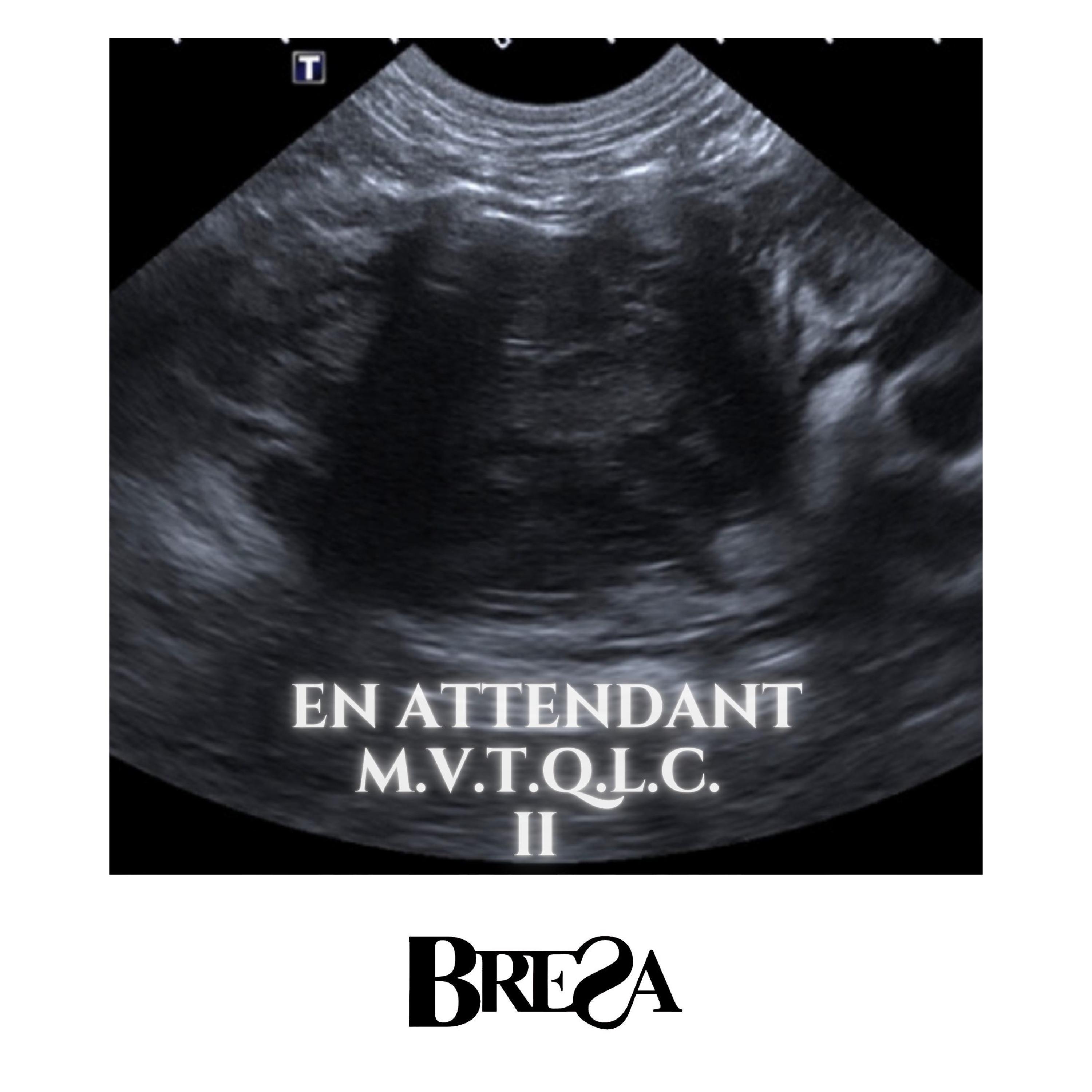 It II - BreSa - 单曲 - 网易云音乐